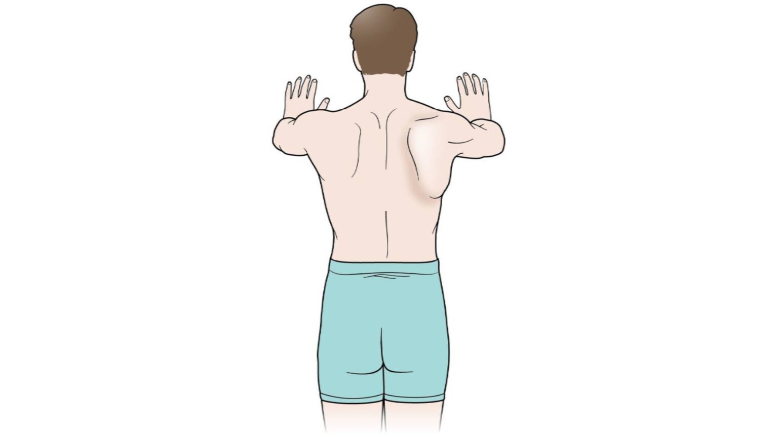 Scapula Push Ups: Muscles Worked, How To Do & Benefits